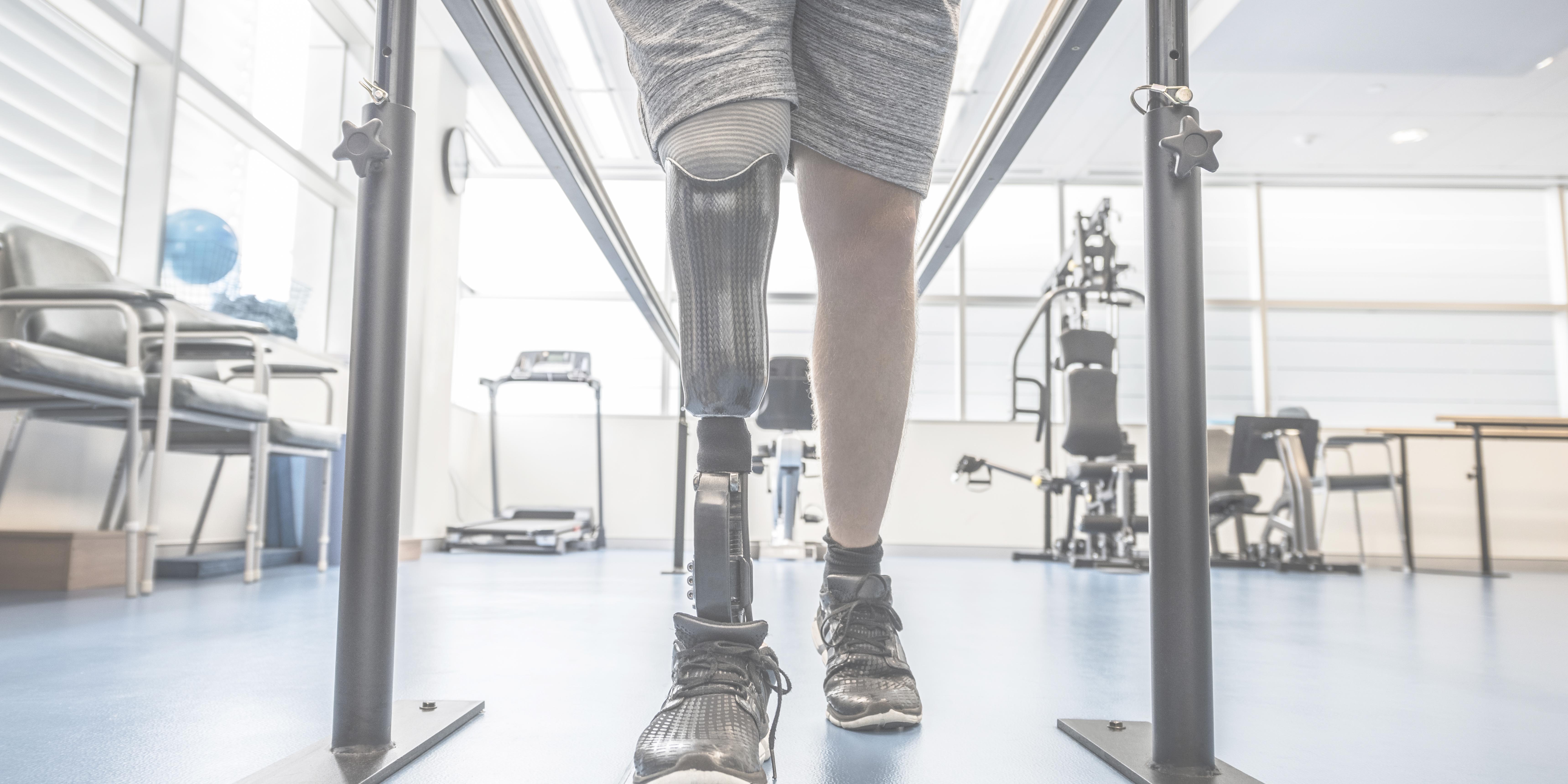 Prosthetics and Orthotics applicants | University of Strathclyde