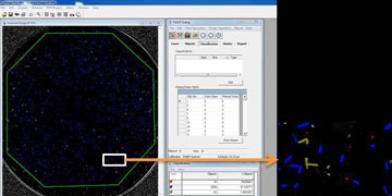 Fibre length analysis | University of Strathclyde
